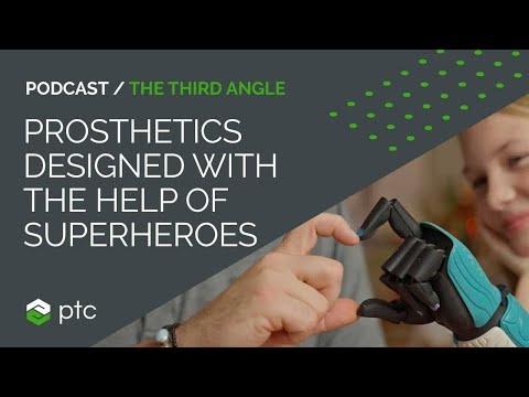 Open Bionics: The hi-tech prosthetics turning disabilities into superp
